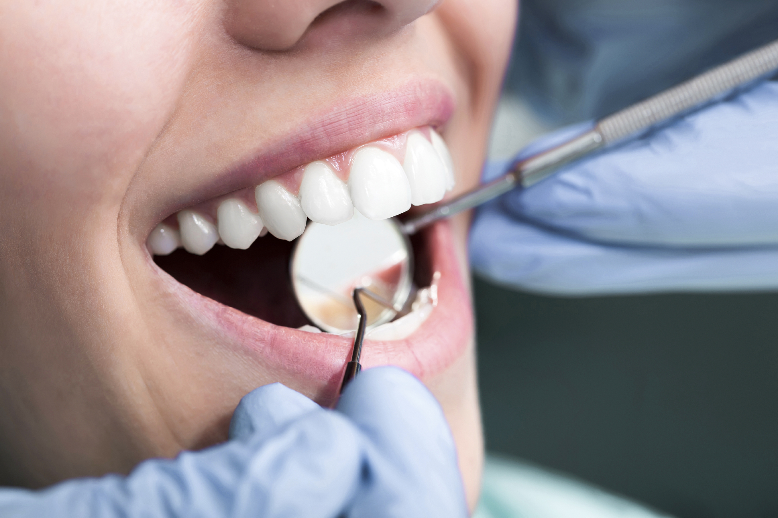 Welsh Carson puts $30 mln into Smile Brands, but debt woes loom